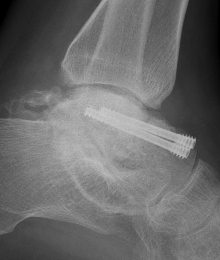 Background | The Bone School